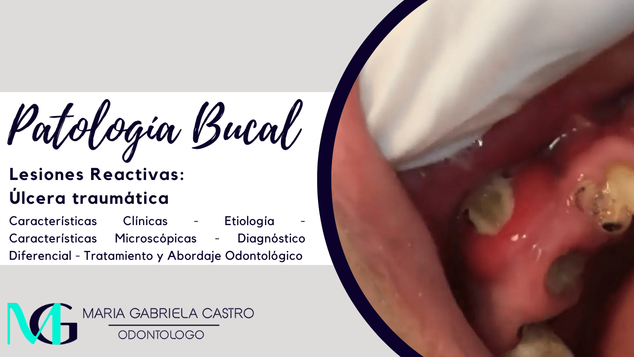 Úlcera traumática: Características Clínicas, Etiología, Características ...