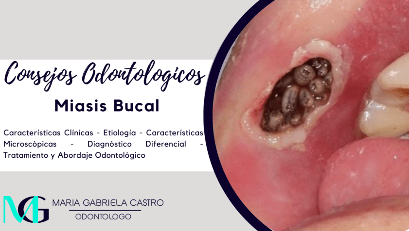 Miasis: Características Clínicas, Etiología, Características ...