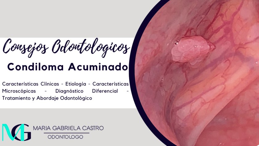 Condiloma Acuminado: Características Clínicas, Etiología ...